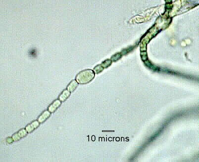 Nostoc And Anabaena