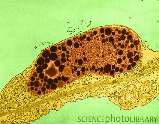 Kromoplast / tokrmplst (2).jpg